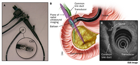 Your GI Center Gastroenterology – EUS