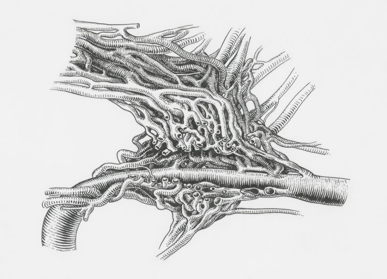 ERCP Procedure in Houston & Southeast Texas - Your GI Center